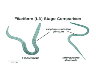 Strongyloides Stercoralis Filariform Larvae