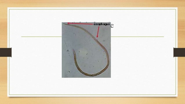 Strongyloides stercoralis | PPT