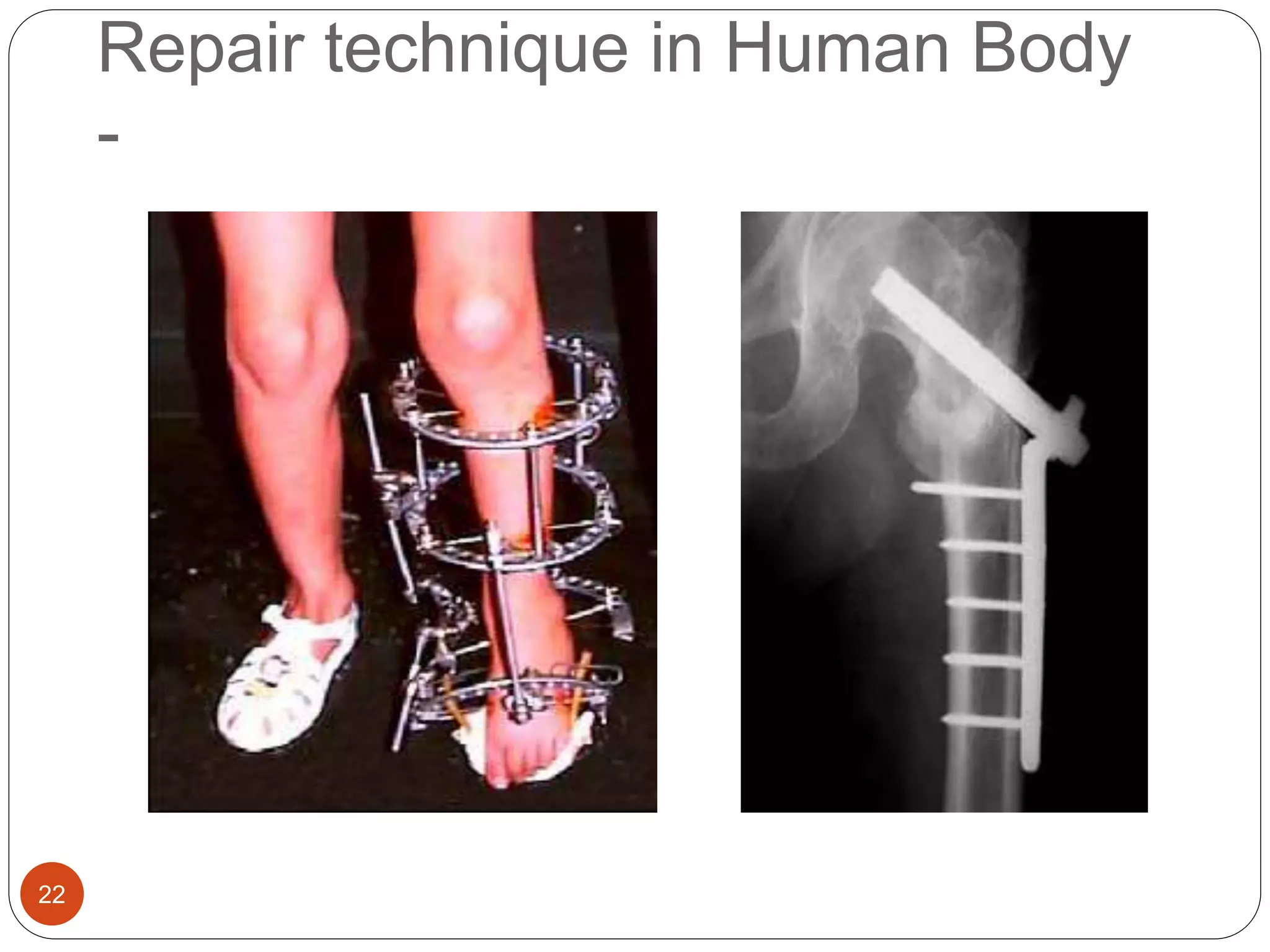 Structural behavior of bones in human body | PPT