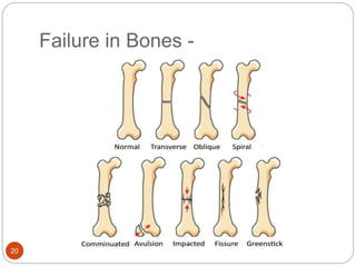 Structural behavior of bones in human body | PPT