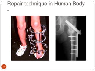 Structural behavior of bones in human body | PPT