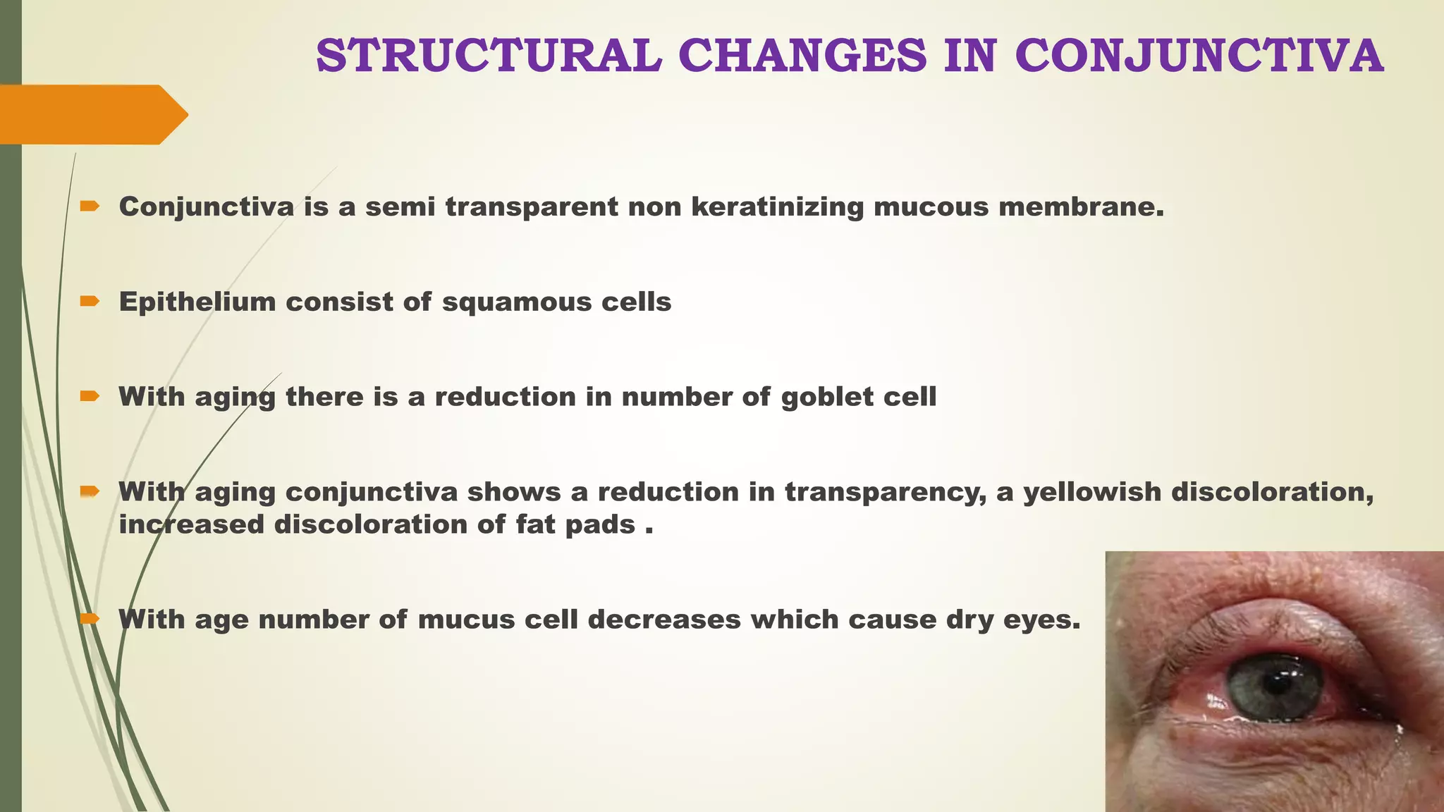 Structural cnanges in the eyes by rb | PPTX