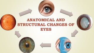 Structural cnanges in the eyes by rb | PPTX