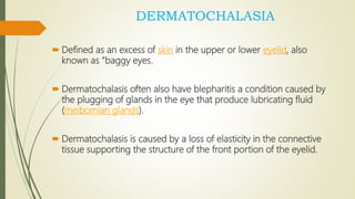 Structural cnanges in the eyes by rb | PPTX