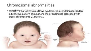 STRUCTURAL CONGENITAL ANOMALIES in neonates.pptx