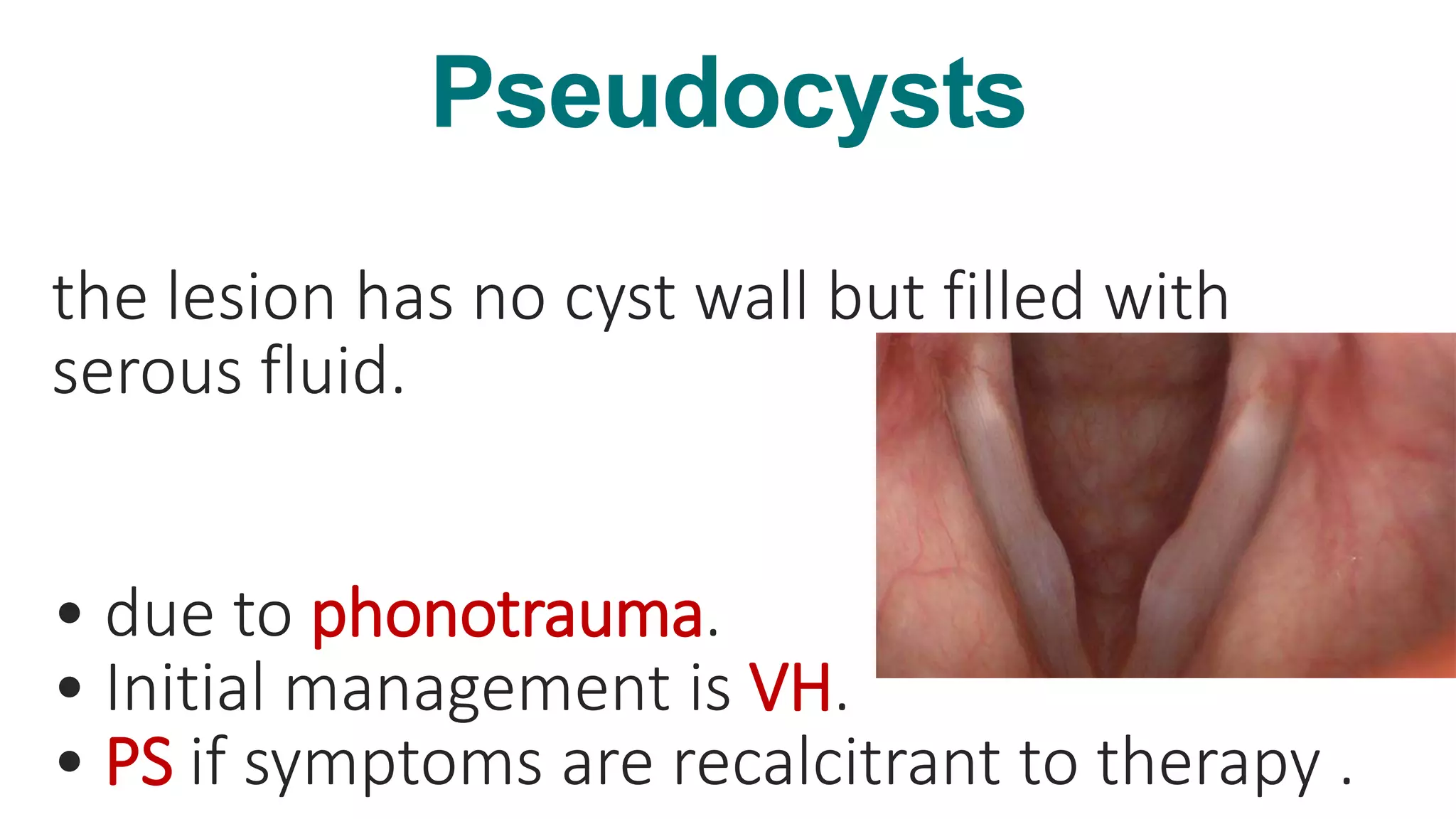 STRUCTURAL DISORDERS of the vocal cords.pptx