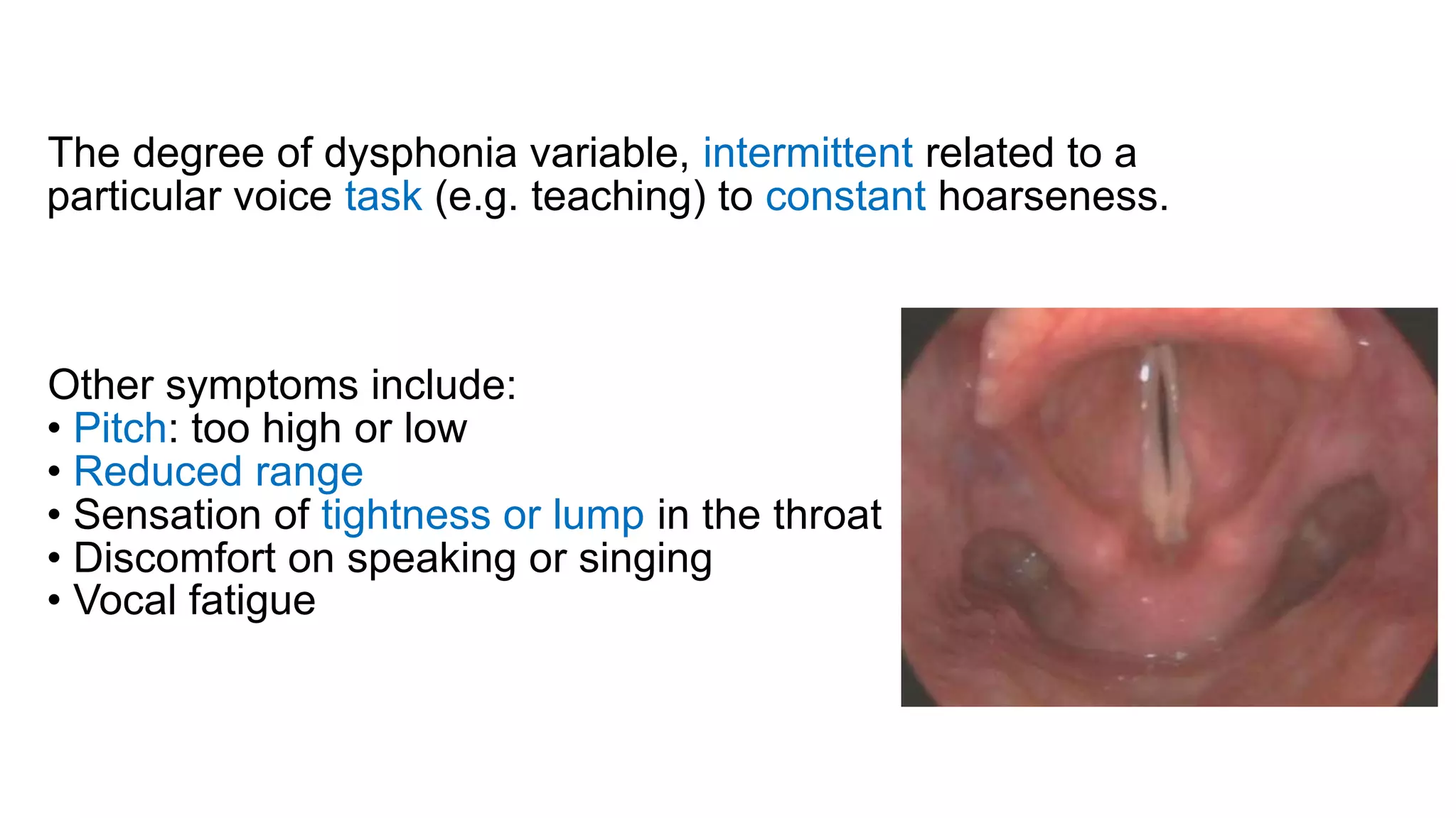 STRUCTURAL DISORDERS of the vocal cords.pptx