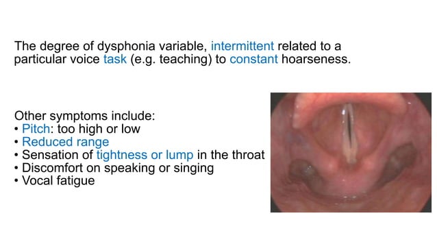 STRUCTURAL DISORDERS of the vocal cords.pptx