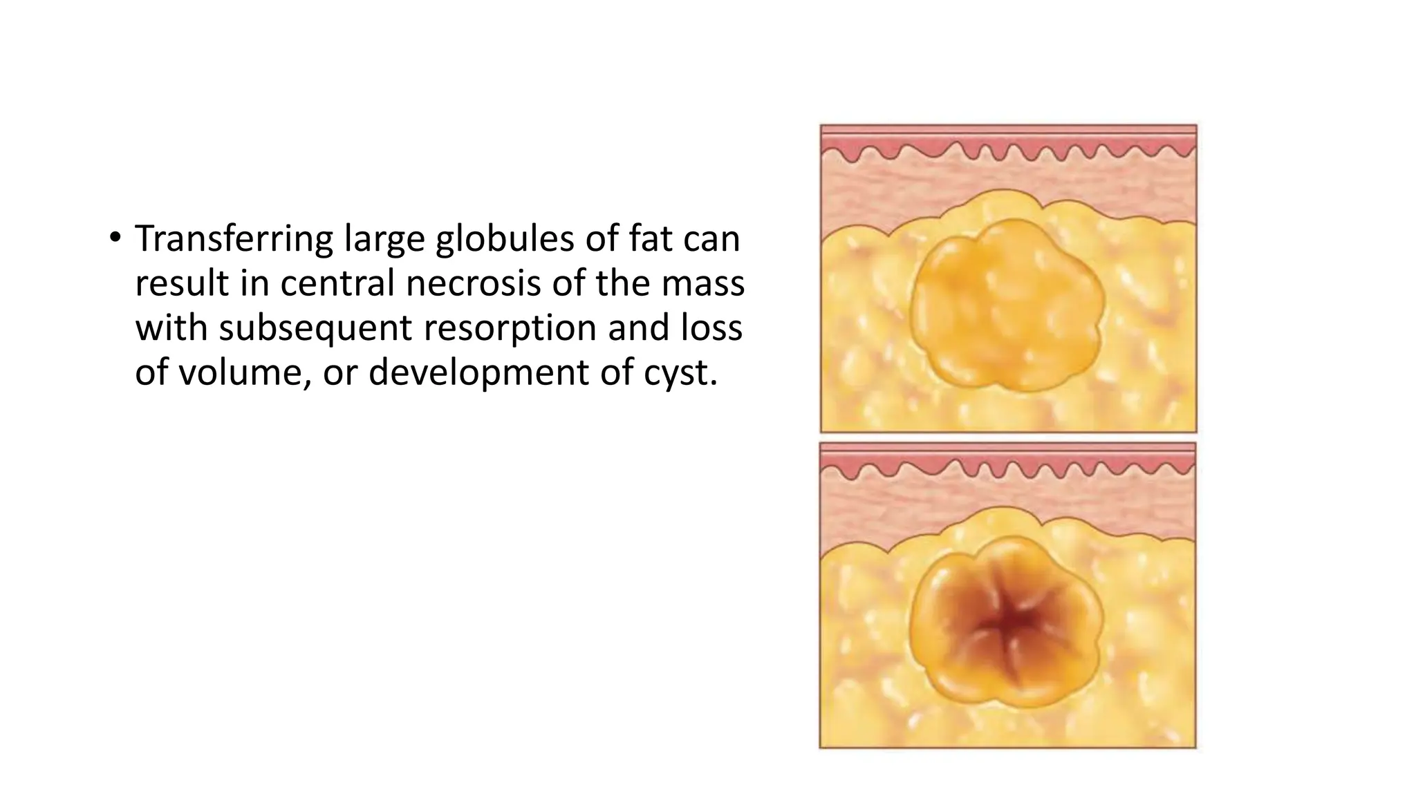 Structural fat grafting in plastic surgery. | PPTX