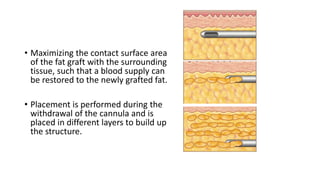 Structural fat grafting in plastic surgery. | PPTX