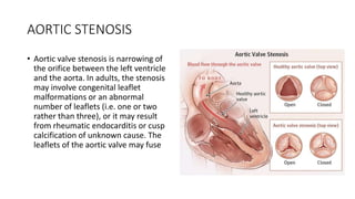 STRUCTURAL HEART DISEASES IN THE HEART.pptx