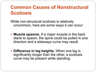 Structural vs. nonstructural scoliosis - cordus | PPT
