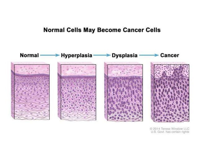 Structure and Characteristics of Normal and Cancerous cells.pptx ...