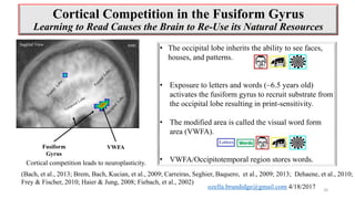 Structure and function of the left temporal lobe | PPT