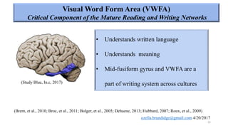 Structure and function of the left temporal lobe | PPT