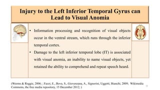 Structure and function of the left temporal lobe | PPT
