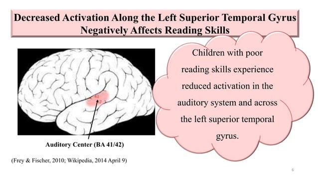 Structure and function of the left temporal lobe | PPT