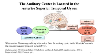 Superior Temporal Gyrus