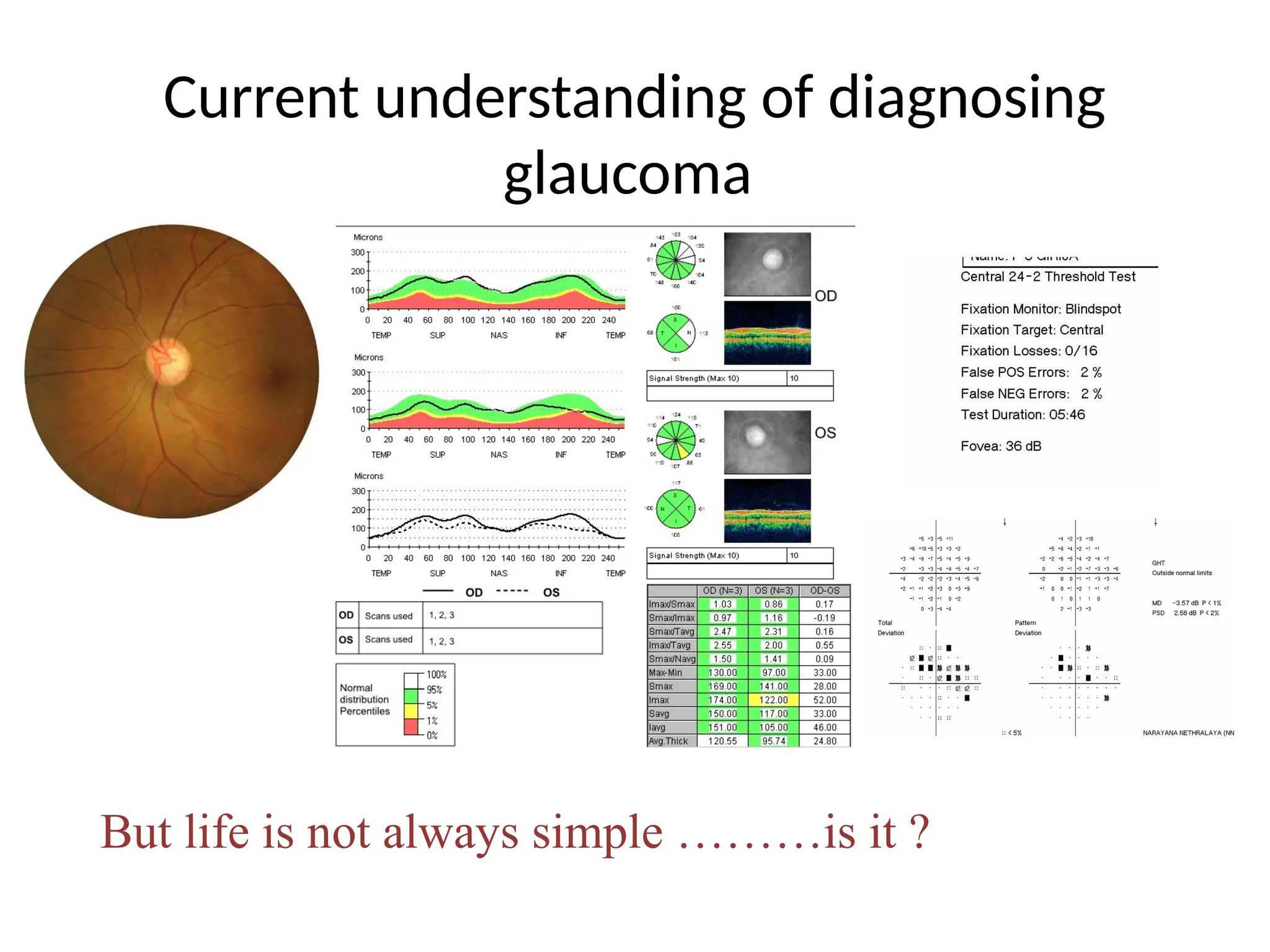 Structure and function relationship in glaucoma Vapi meet Dr Manan.pptx