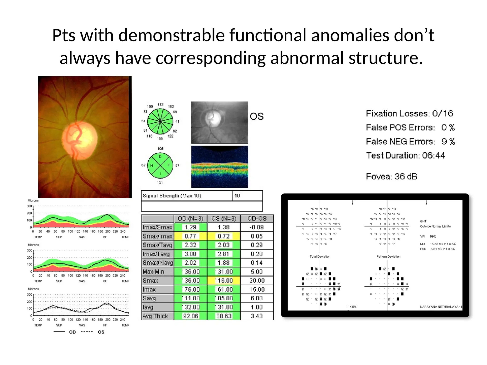 Structure and function relationship in glaucoma Vapi meet Dr Manan.pptx