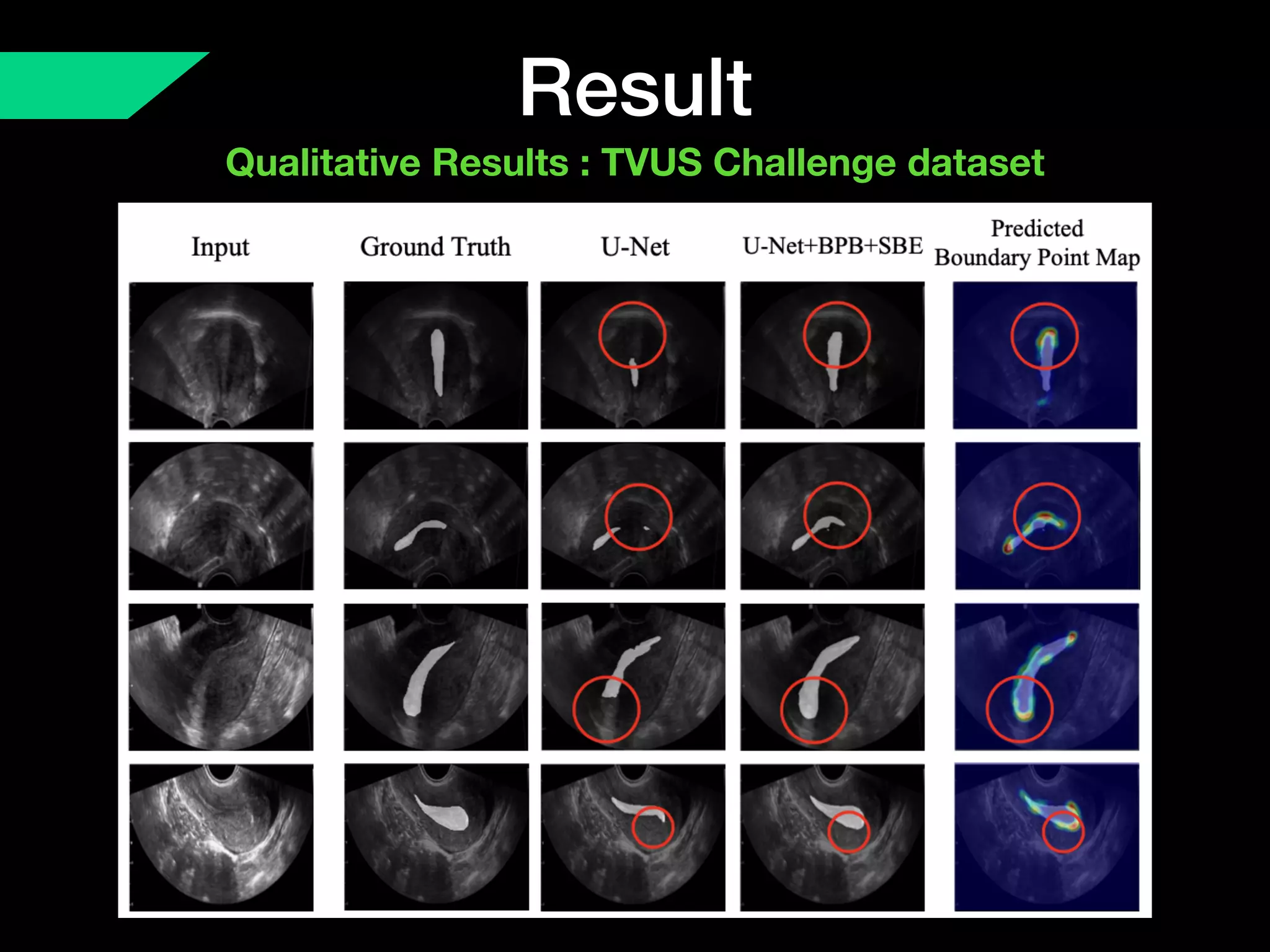Review : Structure Boundary Preserving Segmentation for Medical Image with Ambiguous Boundary | PPT