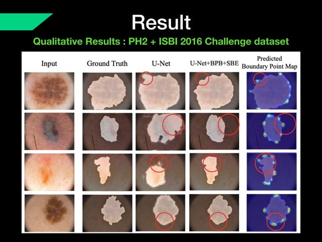 Review Structure Boundary Preserving Segmentation For Medical Image With Ambiguous Boundary Ppt