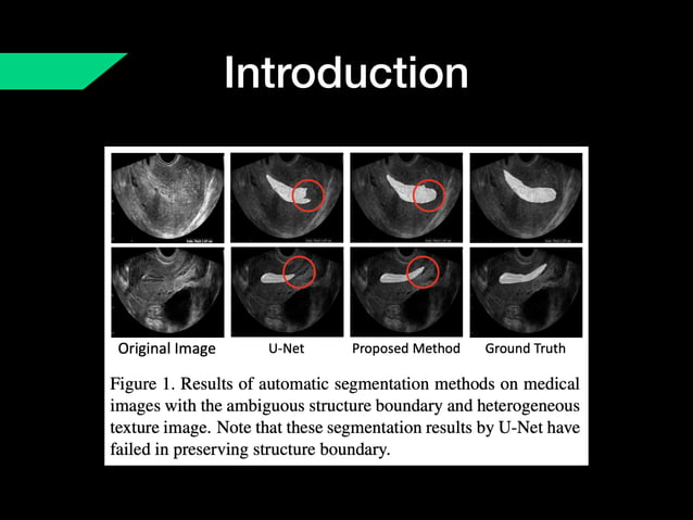 Review Structure Boundary Preserving Segmentation For Medical Image With Ambiguous Boundary Ppt