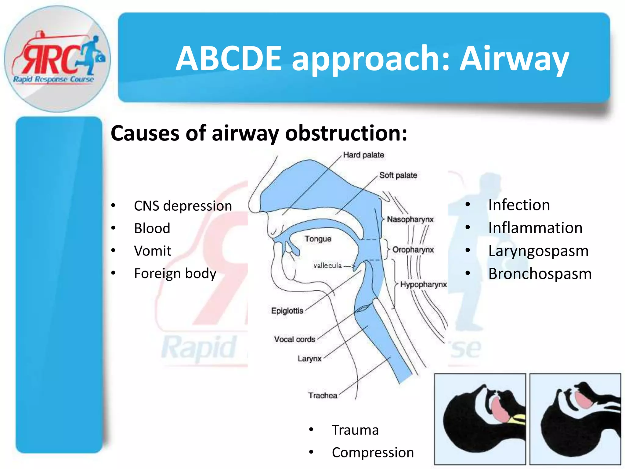 Structured approach for critically ill patient | PPTX