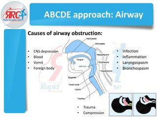 Structured approach for critically ill patient | PPTX