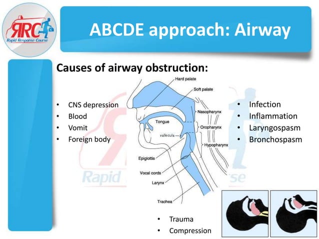 Structured approach for critically ill patient | PPTX