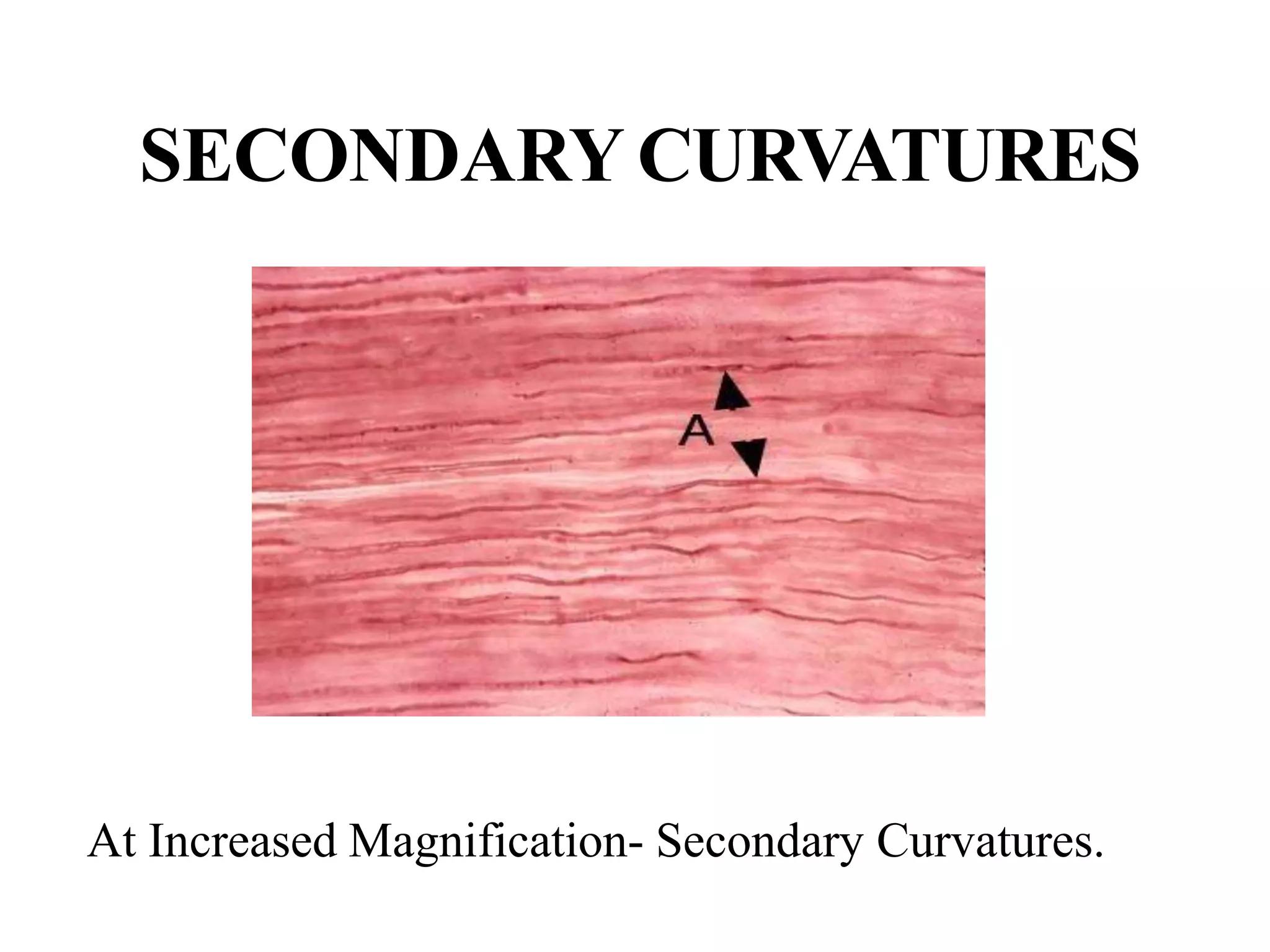 Structure of dentine | PPTX