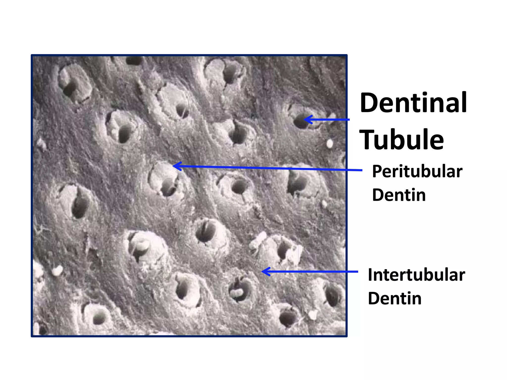 Structure of dentine | PPTX