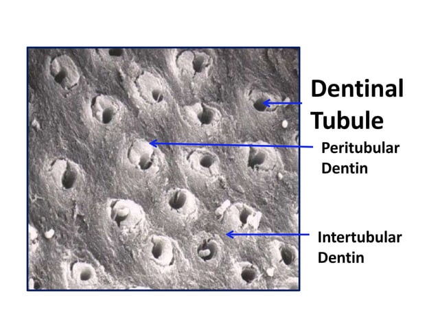 Structure of dentine | PPTX