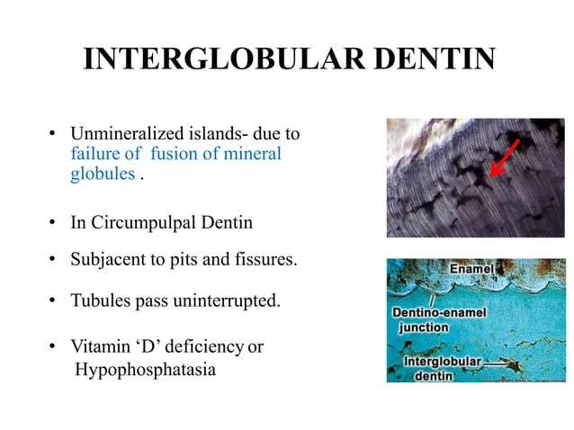 Structure of dentine | PPTX