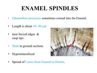 Structure of dentine | PPTX