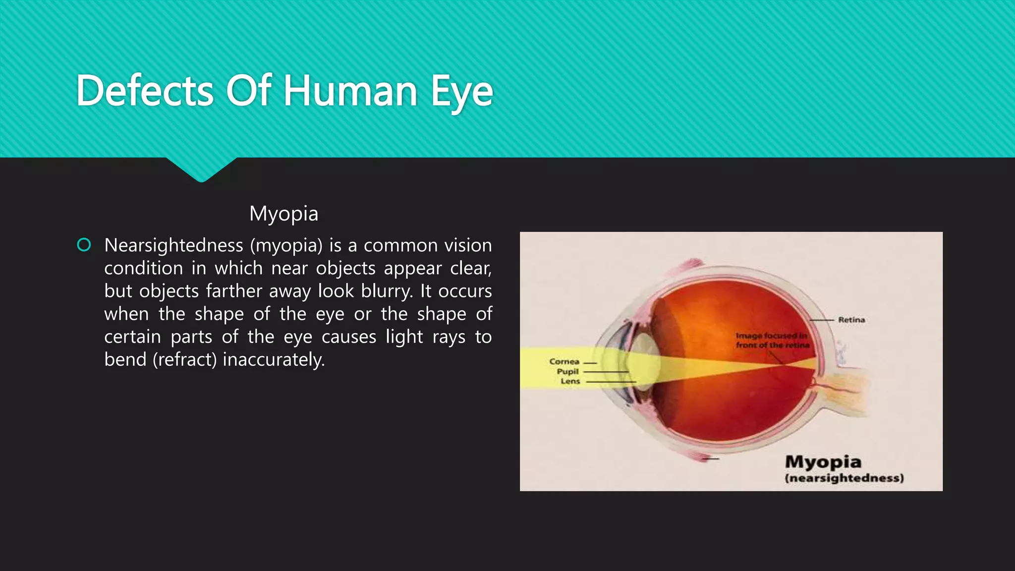 Structure Of Eyes And Its Defects.pptx
