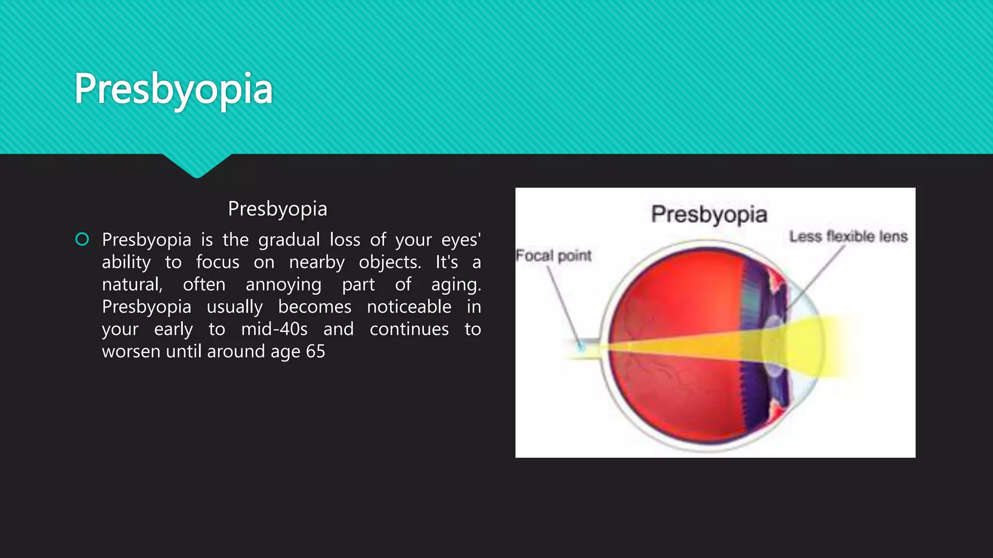 Structure Of Eyes And Its Defects.pptx