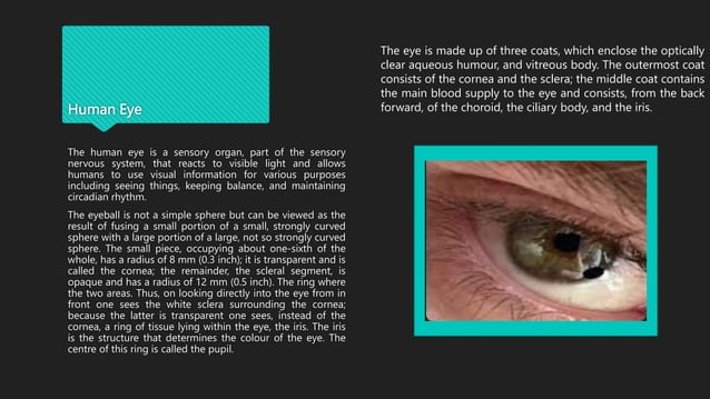 Structure Of Eyes And Its Defects.pptx