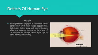 Structure Of Eyes And Its Defects.pptx