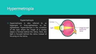 Structure Of Eyes And Its Defects.pptx