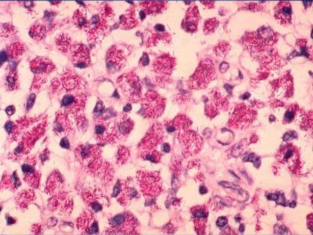 Structure of mycobacterium leprae