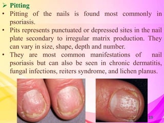 structureofnailanddiseases-180711171533.pdf