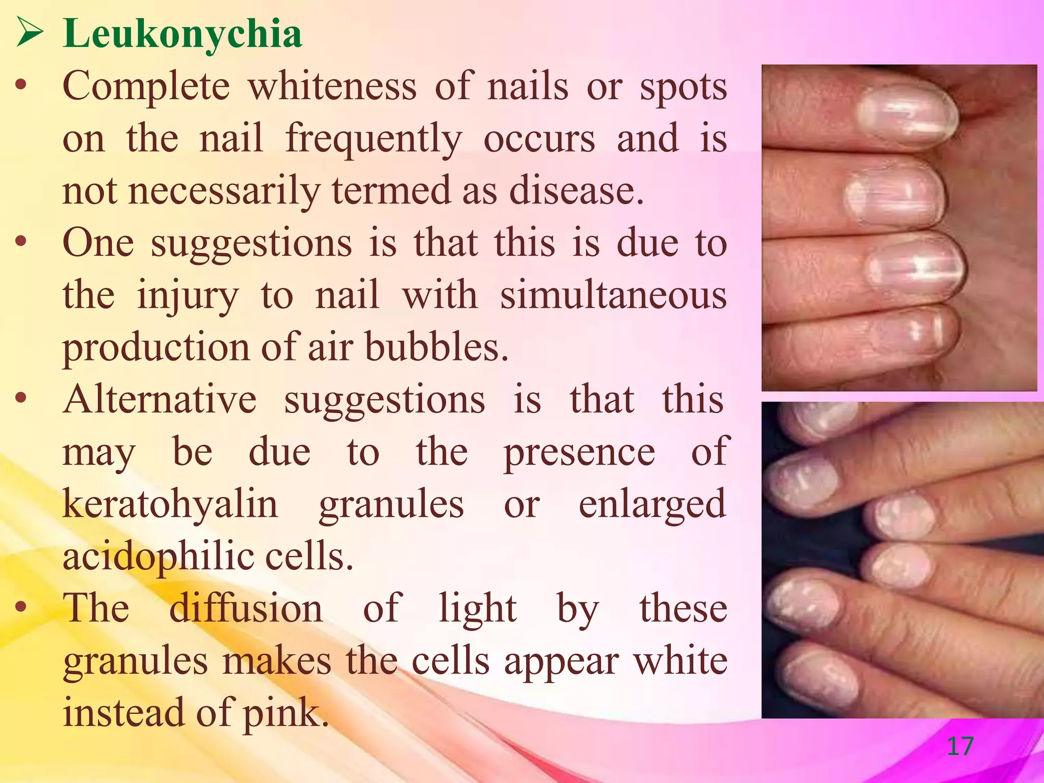 structureofnailanddiseases-180711171533.pptx