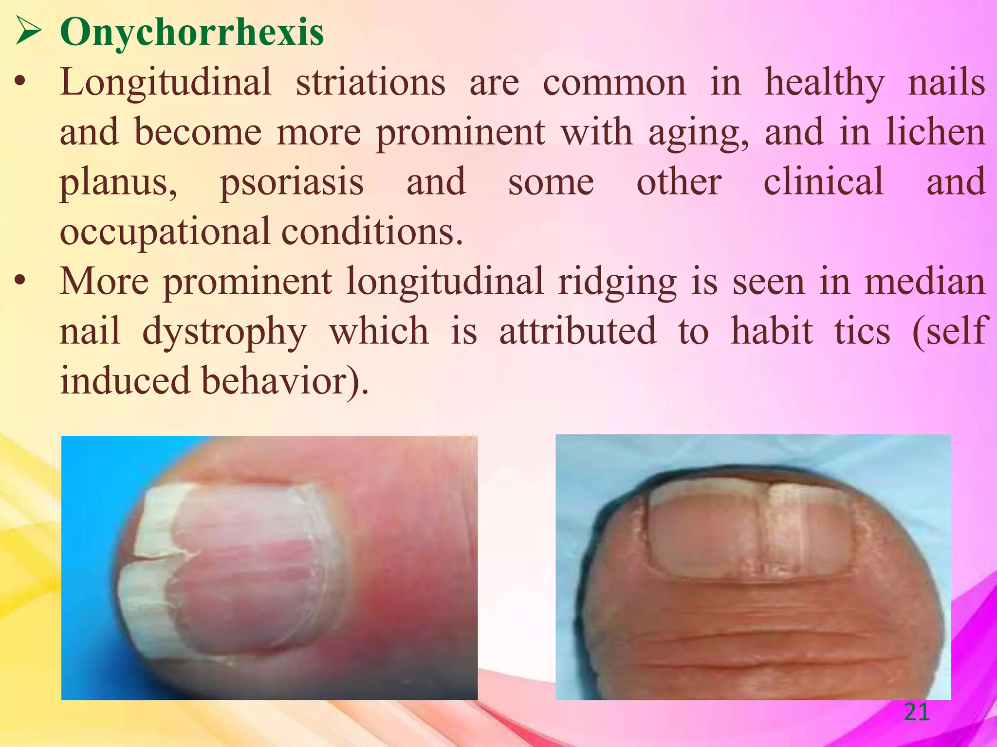 structureofnailanddiseases-180711171533.pptx