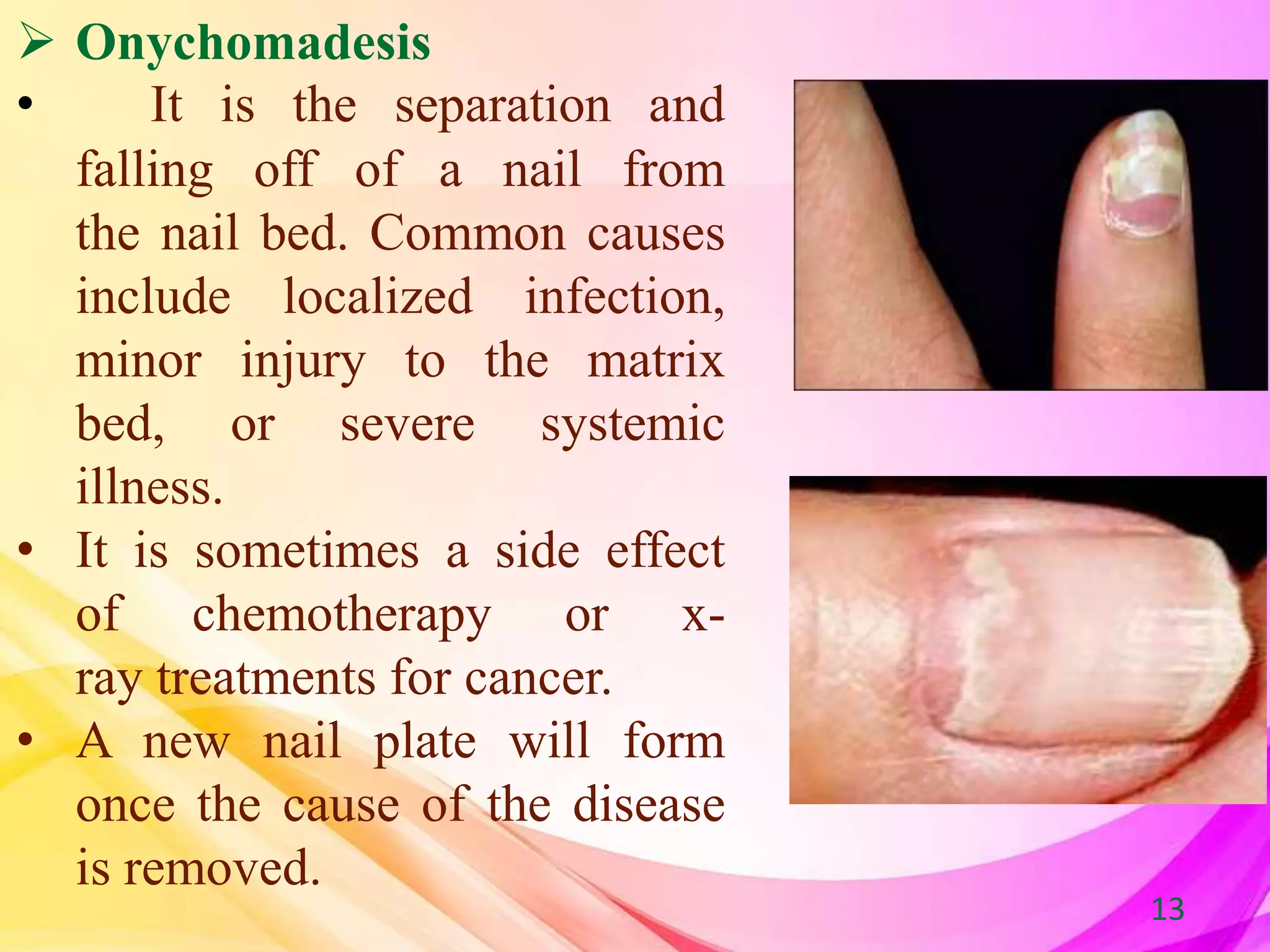 Structure of nail and diseases | PPTX