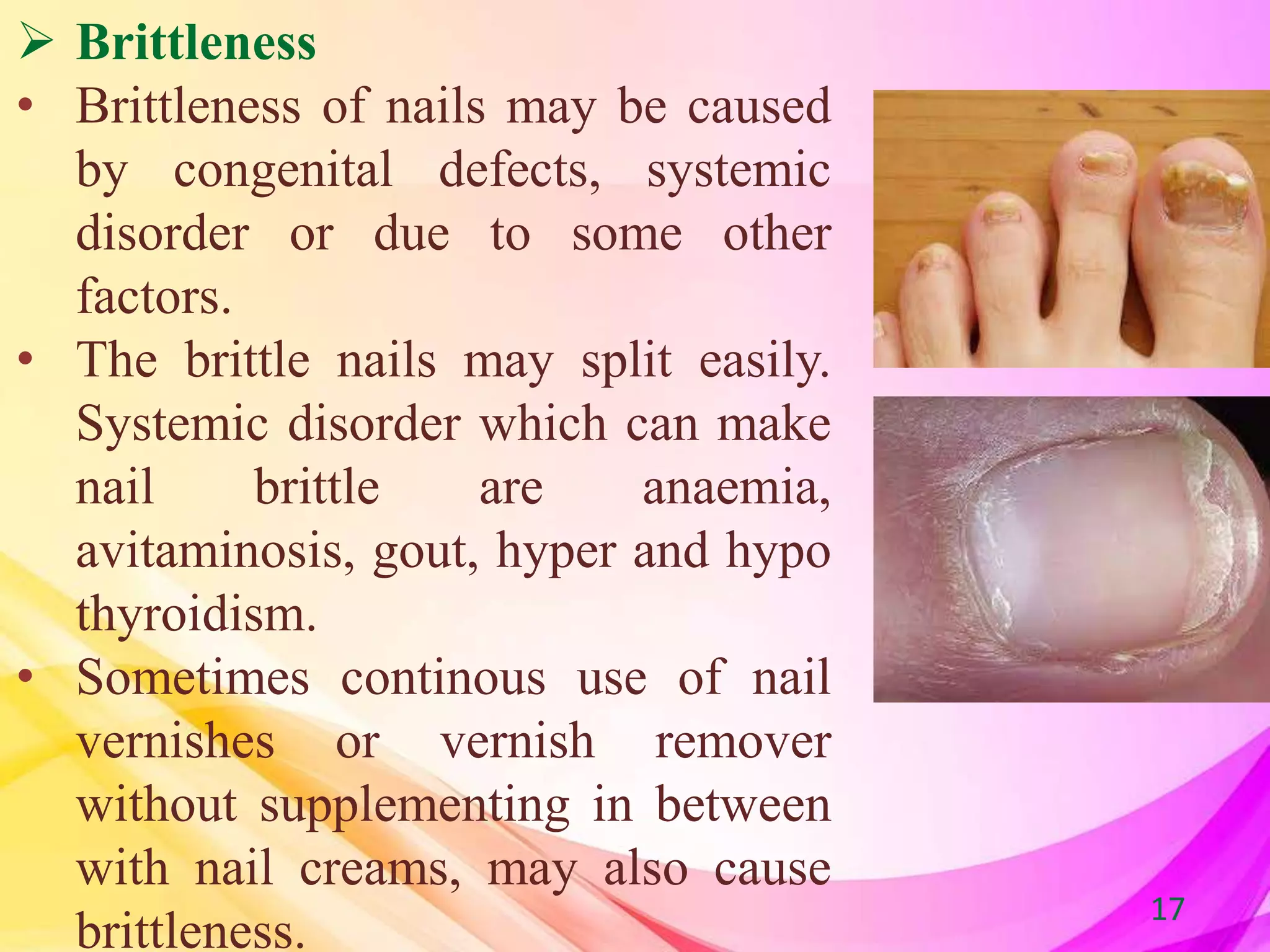 Structure of nail and diseases | PPTX