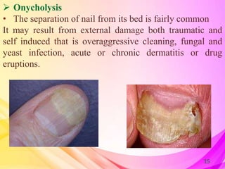 Structure of nail and diseases | PPTX