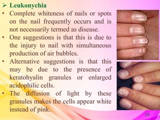 Structure of nail and diseases | PPT