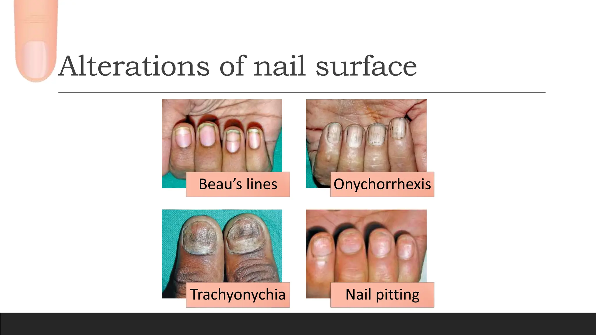 Structure of Nail | PPTX