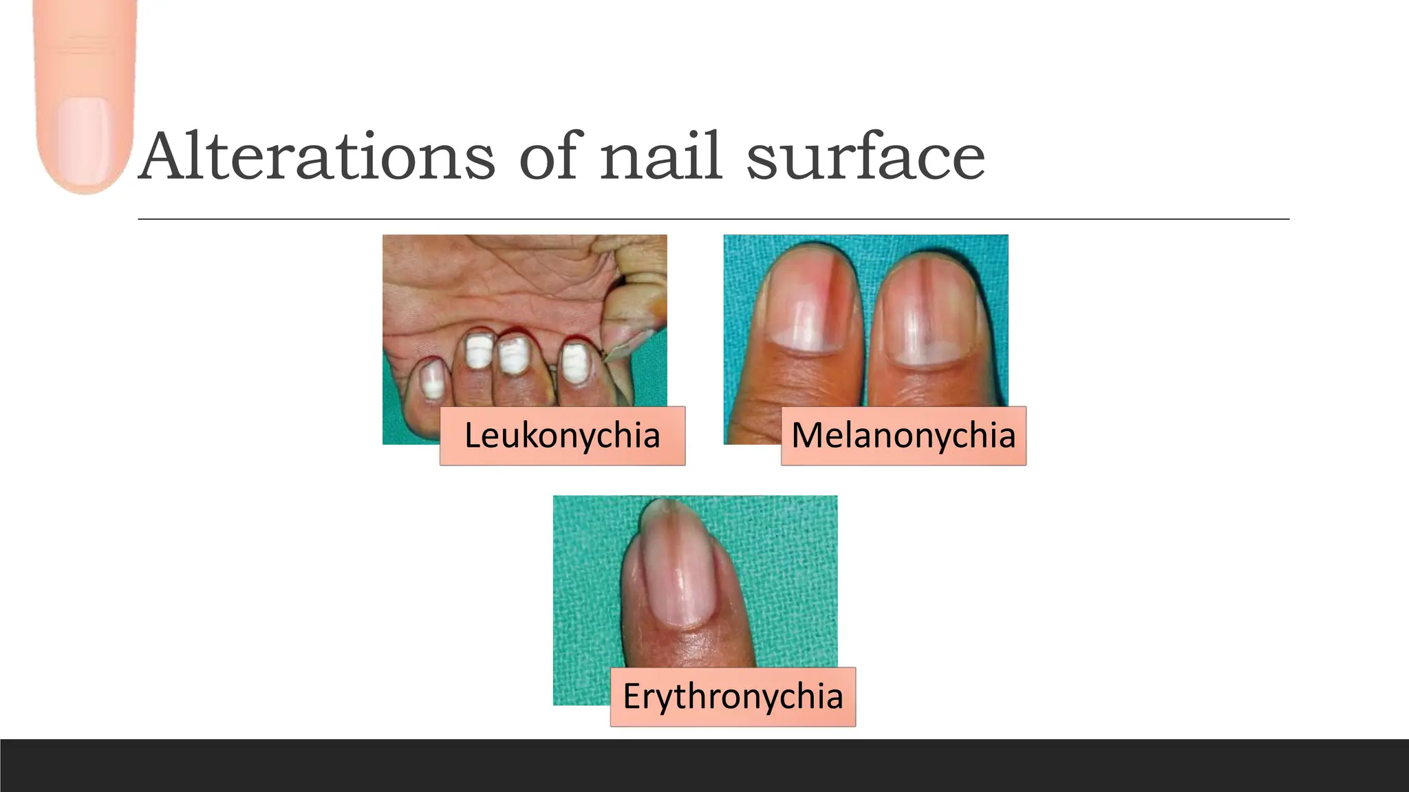 Structure of Nail | PPTX